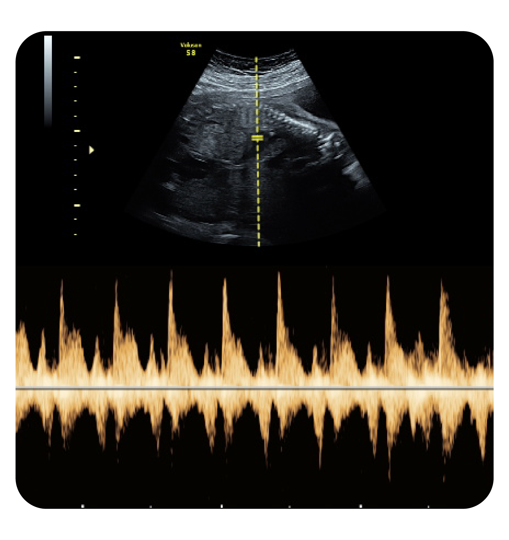 Eco Confirmación De Embarazo Desde La Semana 6 Hasta La 9 Y En Las ...