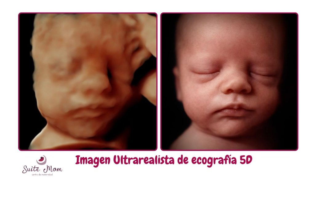 Imágen IA De Tu Ecografía Ecografía 8K HIPERREAL Inteligencia Artificial